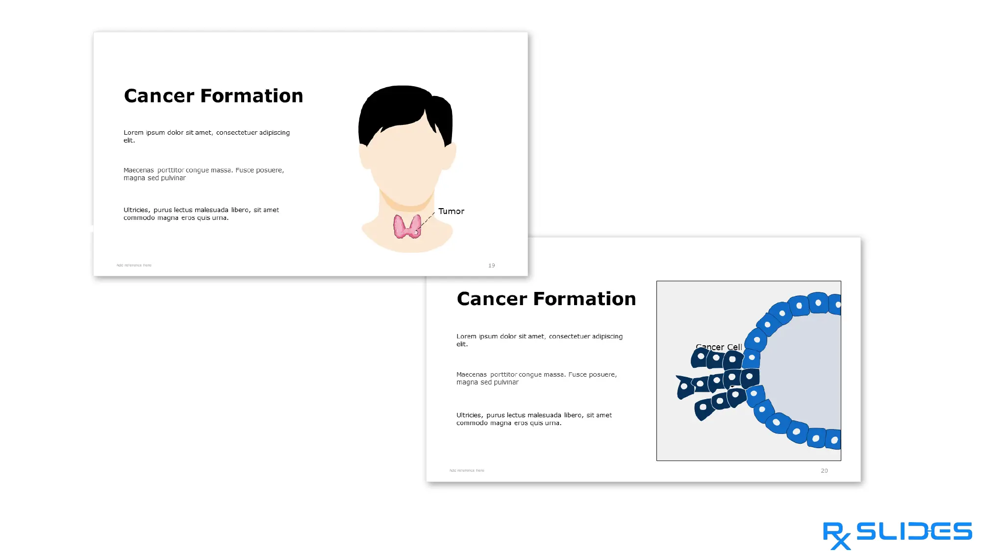 Download Thyroid Cancer Powerpoint Template Rxslides